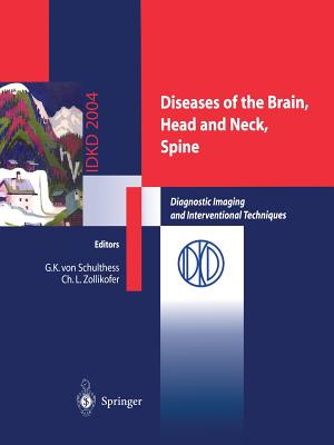 Nwf.com: Diseases of the Brain, Head and Neck, Sp: كتب