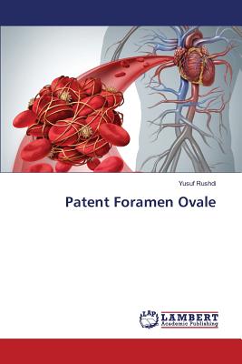 Nwf.com: Patent Foramen Ovale: Rushdi Yusuf: كتب