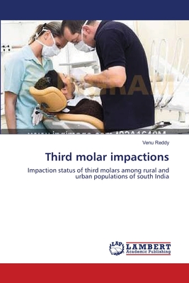 Nwf.com: Third molar impactions: Venu Reddy: كتب