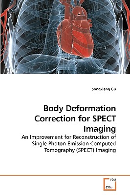 Nwf.com: Body Deformation Correction for SPECT Im: Songxiang Gu: كتب