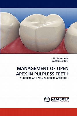 Nwf.com: Management of Open Apex in Pulpless Teet: Keyur Joshi: كتب