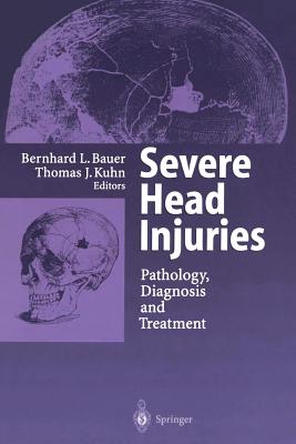 Nwf.com: Severe Head Injuries: كتب