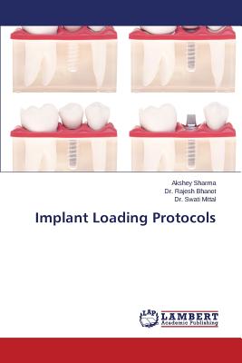 Nwf.com: Implant Loading Protocols: Akshey Sharma: كتب